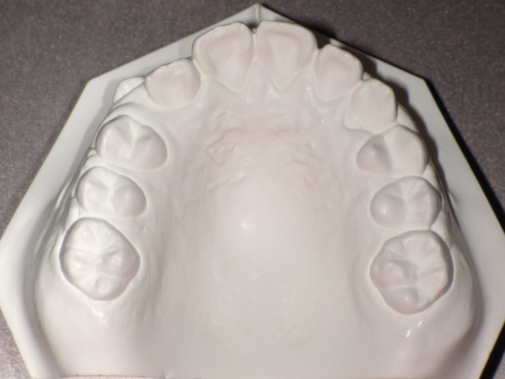 熊本市の歯周病予防、歯科、小児歯科、小児矯正 | 【公式】ひかる歯科ちえこども歯科 | SHOFU DENTAL DIGITAL CAMERA